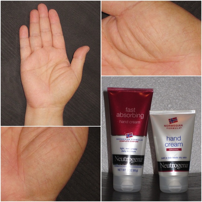 Ooh's World: Psoriasis Living - อยู่กับสะเก็ดเงิน